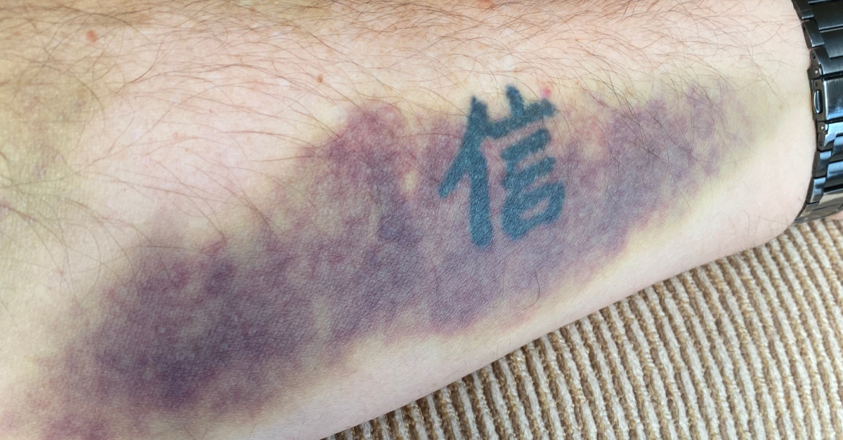 Chapter 20: Injections, bruises, and infusions…oh my!!! - R. Kroll